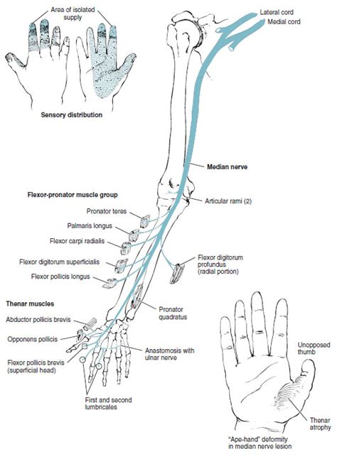 Carpal Tunnel Syndrome Case File