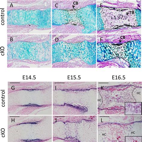 Sternal Abnormalities In Cko Mice Skeletal Preparations Of Control And Download Scientific