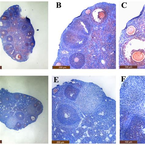 Immunohistochemical Detection Of Lepr In Hom And Wt Ovaries Panel A Download Scientific
