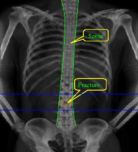 Figure 1 From Secure An Image Based Simulated Telesurgery System Semantic Scholar