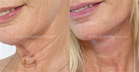 How Much Is Neck Threading At Christopher Lewis Blog