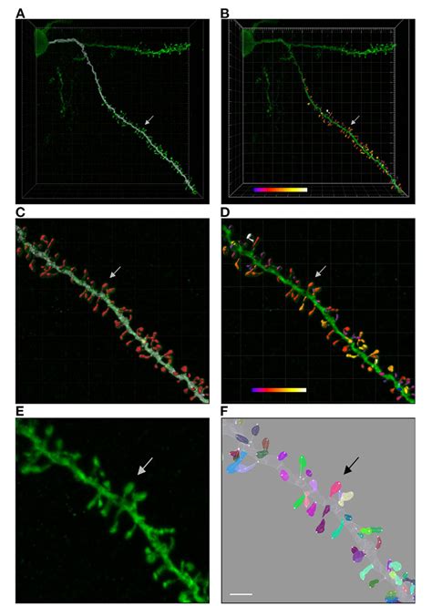 Figure 2 From A Deep Learning Based Workflow For Dendritic Spine Segmentation Semantic Scholar