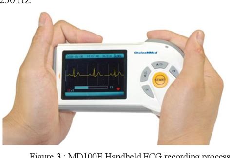 Figure 2 From Ecg Slope Features For Biometric Authentication Semantic Scholar