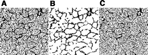 Adipocyte Spatial Distributions In Bone Marrow Implications For