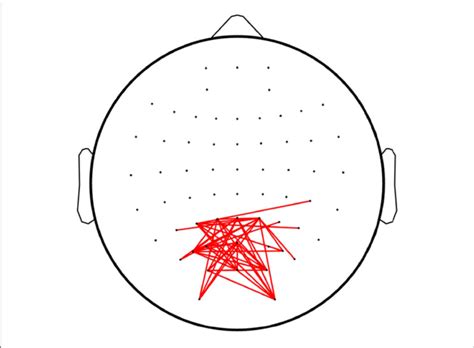 Linkages With Significant Differences Among The Overt Attention And