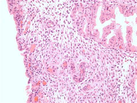 Secretory Endometrium Histology