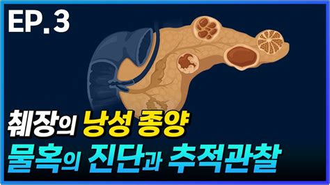【a3】 췌장의 낭성 종양 물혹 총정리 진단 및 추적관찰 Pancbil 췌장낭종 Youtube