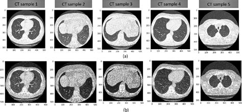 Figure 2 From Nodule Detection With Convolutional Neural Network Using Apache Spark And Gpu