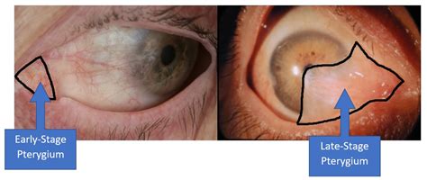 Diagnostics Free Full Text Group And Shuffle Convolutional Neural Networks With Pyramid