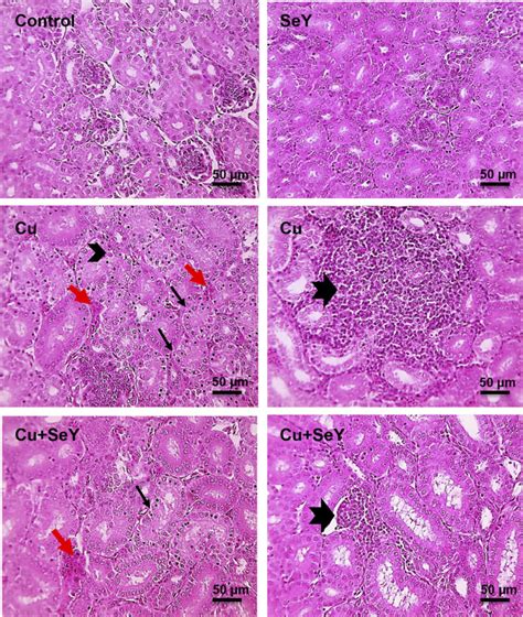 Selenium Enriched Yeast Modulates The Metal Bioaccumulation Oxidant
