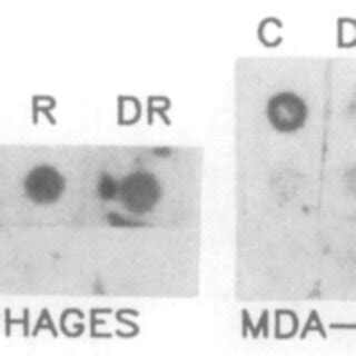 Effect of RU 486 on u-PA gene transcription. Nuclei were isolated from ...