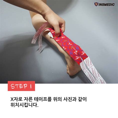국제테이핑 아킬레스건 통증이 아주 심하실 때 도움되는 키네시오 테이핑 심화 방법 입니다~ 사진 속