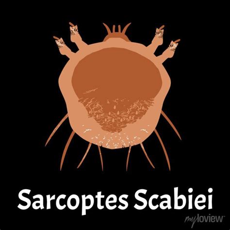 Sarcoptes Scabiei Scabies Sexually Transmitted Disease Infographics