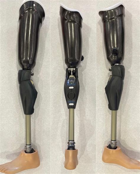 A Look At The X3 Microprocessor Knee — Prosthesis Delivered Recently The… Integrity