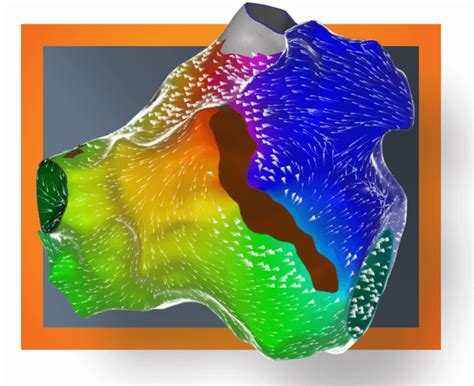 3d Navigation System Biosense Webster Jandj Medtech