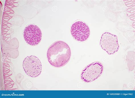 Ascaris Lumbricoides Stock Image Image Of Experiment 169339881