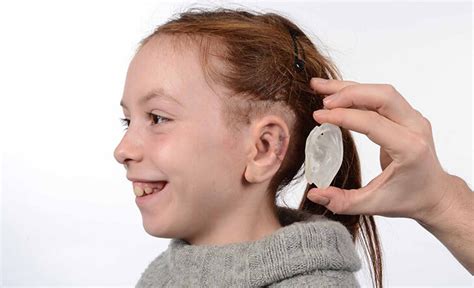 Can You Fix The Microtia Surgery Rib Cartilage Ear Reconstruction