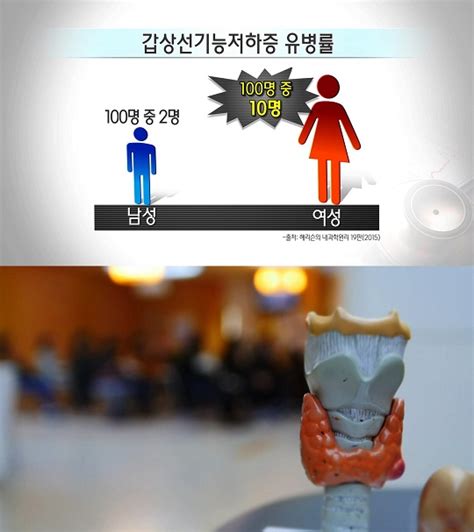 Ebs ‘명의 그레이브스병 갑상선기능항진증의 원인 나눔뉴스 사랑받는 국민의 신문 기부문화를 선도하는 대표신문