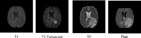 Multi Modal Convolutional Neural Networks For Brain Tumor Segmentation