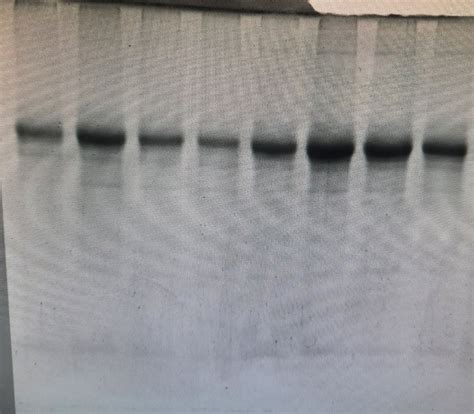 281 Questions With Answers In Platelets Science Topic
