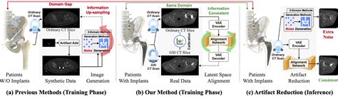 reducing ct metal artifacts by learning latent space alignment with