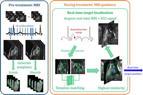 Real Time Target Localization Workflow For The Left Atrium La By Download Scientific Diagram