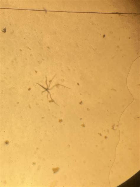Does Anyone Know What This Is Found In A Fecal Float In A Shelter R Does Anyone Know What This Is Found In A Fecal Float In A Shelter R