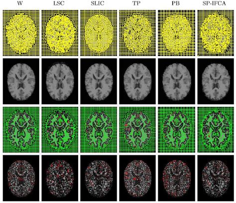 Superpixels Extraction By An Intuitionistic Fuzzy Clustering Algorithm