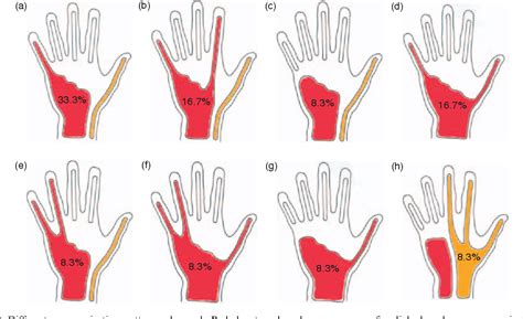 Flexor Tendon Sheath