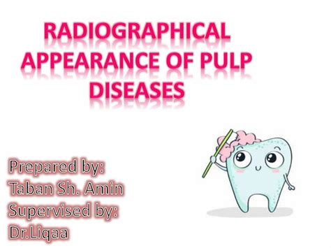 Pdf Radio Pulp Diseases Dokumentips