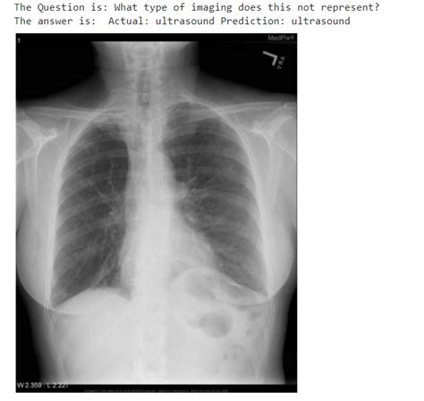 GitHub Bbabina Visual Question Answering Visual Question Answering On Medical Data
