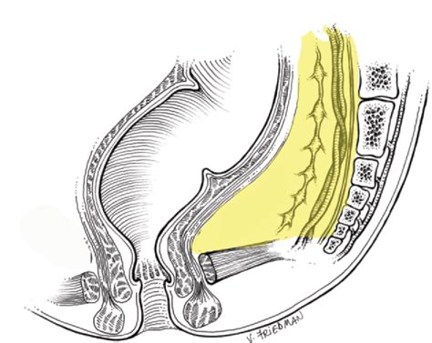 Prevertebral Abscess Semantic Scholar