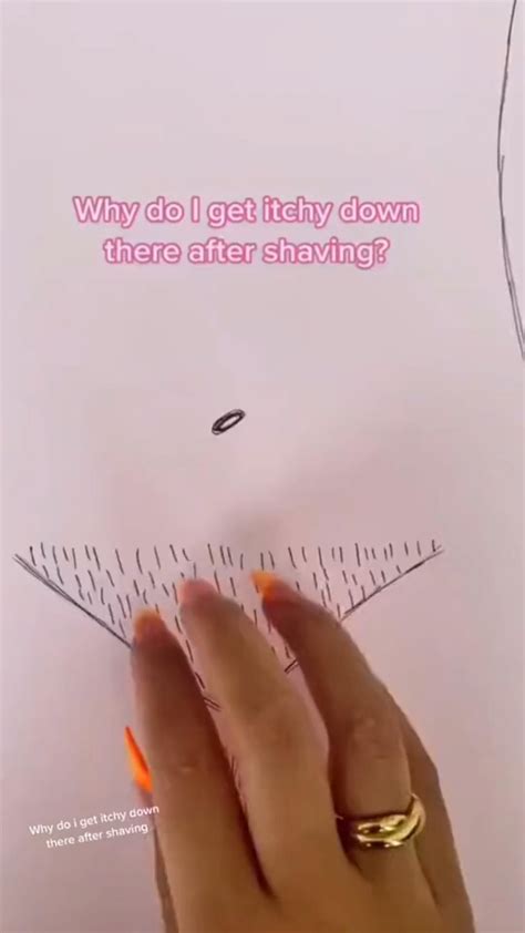 How To Avoid Razor Bumps And Ingrown Hair Artofit