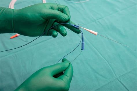 Cateterismo Entenda O Que é E Para Que Serve O Procedimento Ser