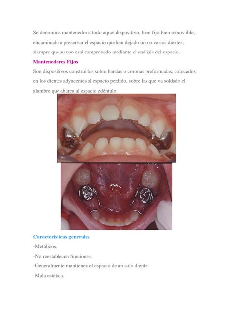 Mantenedores De Espacio En Odontopediatría Pdf Odontología Boca