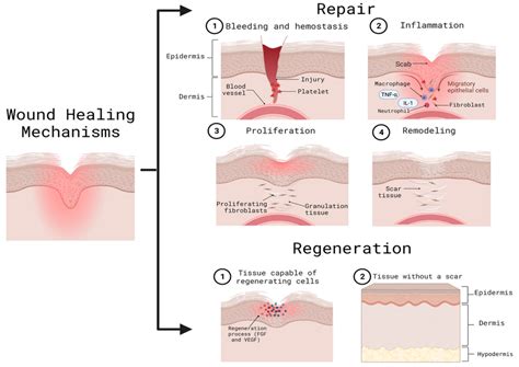 Pro Inflammatory Signaling Pathways Of Tlr4 Lps And Lbp Bind Leading