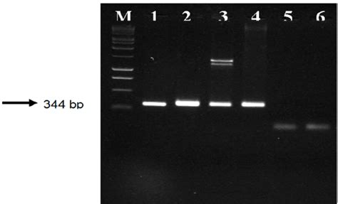 Consensus Sequences Obtained As Deduced Nucleotide Sequences