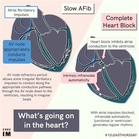 85m With A History Of Afib Cad Sp Pci Presents With Syncope Core Im Podcast