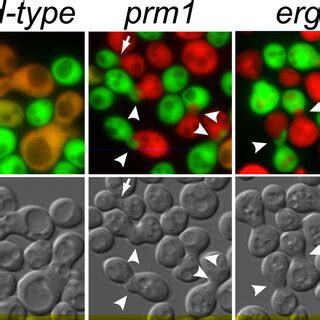 Ergosterol Biosynthesis And Plasma Membrane Fusion A Enzymes And