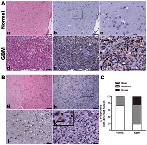 Increased Expression And Nuclear Localization Of Nrf2 In Human