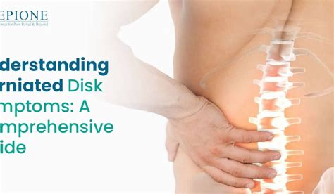 Understanding Herniated Disk Symptoms A Comprehensive Guide Epione