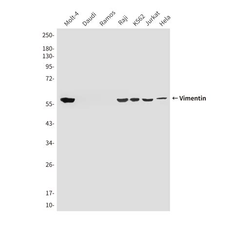 Vimentin 19r15 Mouse Monoclonal Antibody