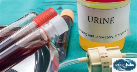 Affordable Std Testing Near Me Portland Oregon