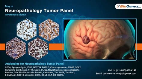 Biogenex On Linkedin Biogenex Ihc Antibodies Diagnosis Neurologicaltumours Brain…