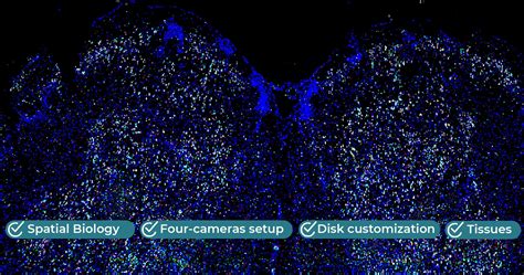 New Confocal Solutions For 3d Spatial Transcriptomics Crestoptics