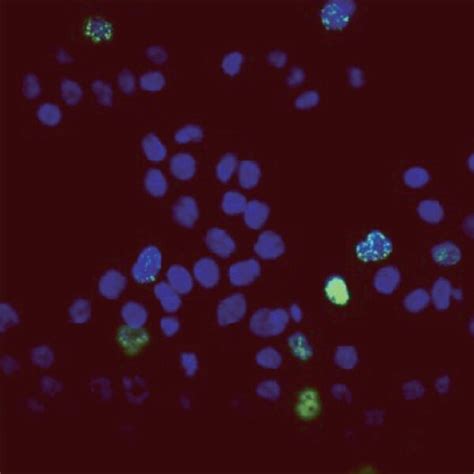 Pora Loop4 Causes A Decrease In The Proportion Of Cells Transitioning