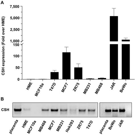 The Csh Gene Is Expressed At Variable Levels In Breast Cancer And