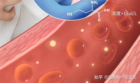 备孕路上的隐秘关卡：血同型半胱氨酸（hcy），你查了吗？ 知乎