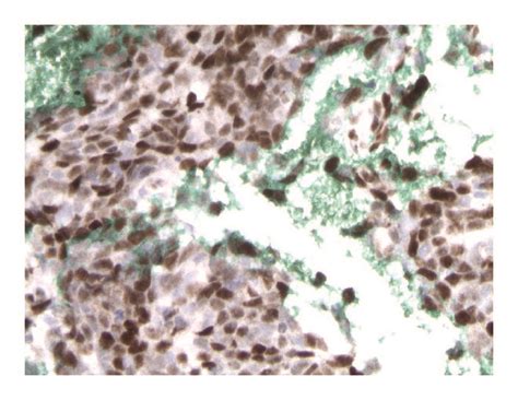 Photomicrographs Of The Needle Core Biopsy Of The Conglomerate Download Scientific Diagram