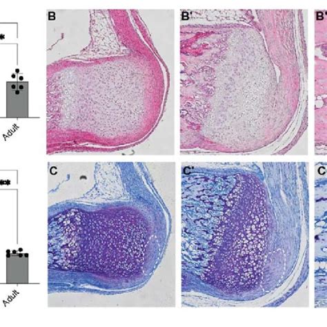 During Postnatal Development The Cellularity Of The Enthesis